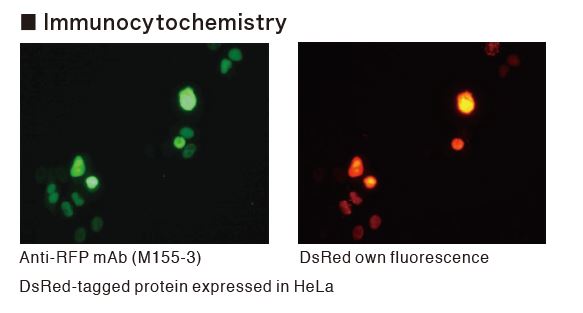 RFP (Red Fluorescent Protein)