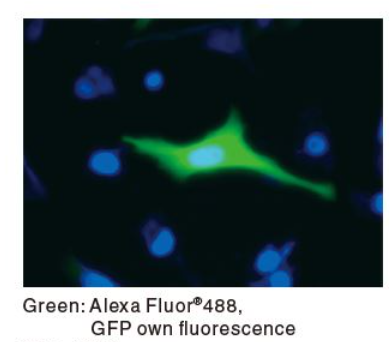 GFP (Green Fluorescent Protein)